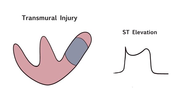 Transmural Images – Browse 19 Stock Photos, Vectors, and Video | Adobe ...