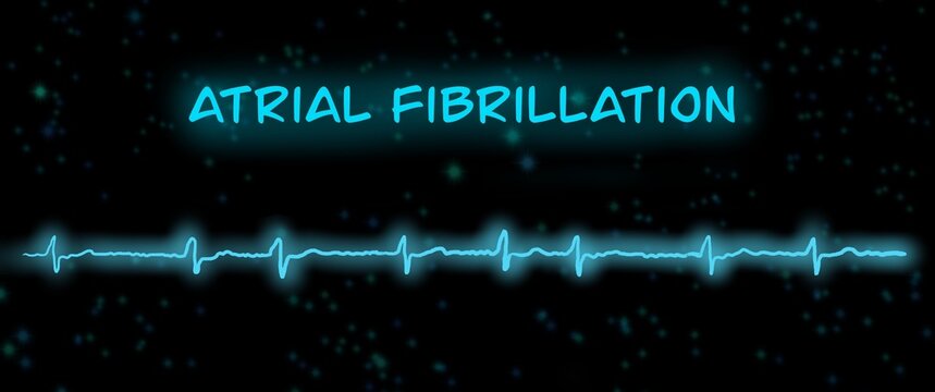 Ecg Atrial Flutter Youtube