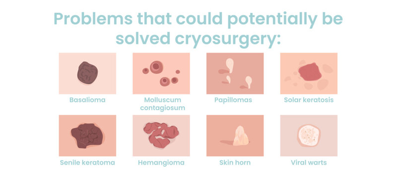 Basaliom-Bilder: Stock-Fotos & -Videos. | Adobe Stock