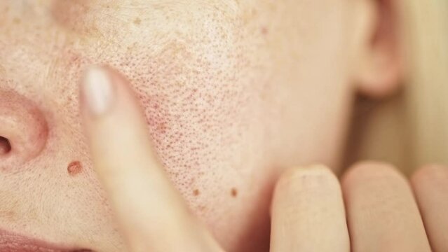 รูปภาพMicrocomedones – เลือกดูภาพถ่ายสต็อก เวกเตอร์ และวิดีโอ49,530 ...