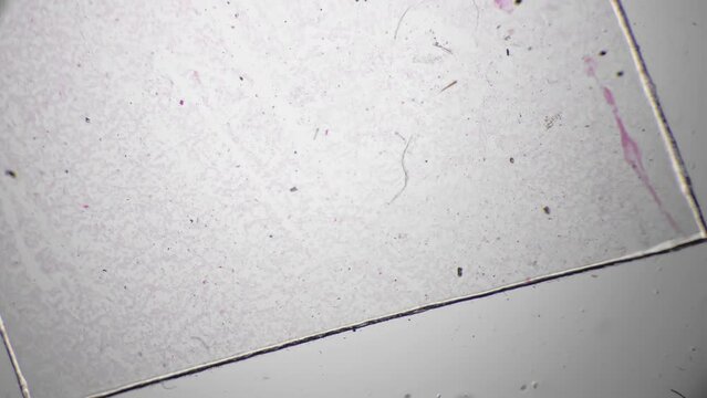 Smear Under Microscope Images – Browse 865 Stock Photos, Vectors, and ...