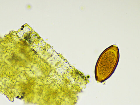 Algae Under Microscope 400x