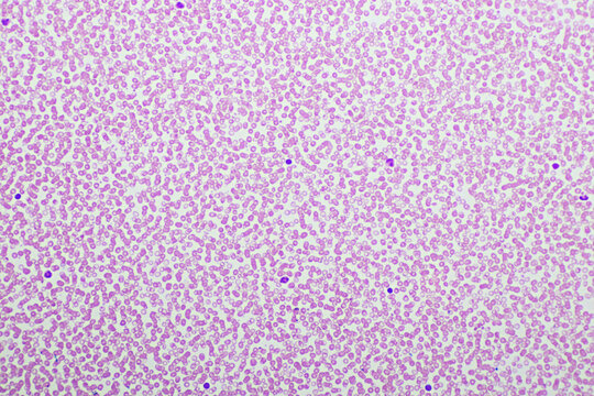 Microcyte Bilder – Durchsuchen 391 Archivfotos, Vektorgrafiken und ...