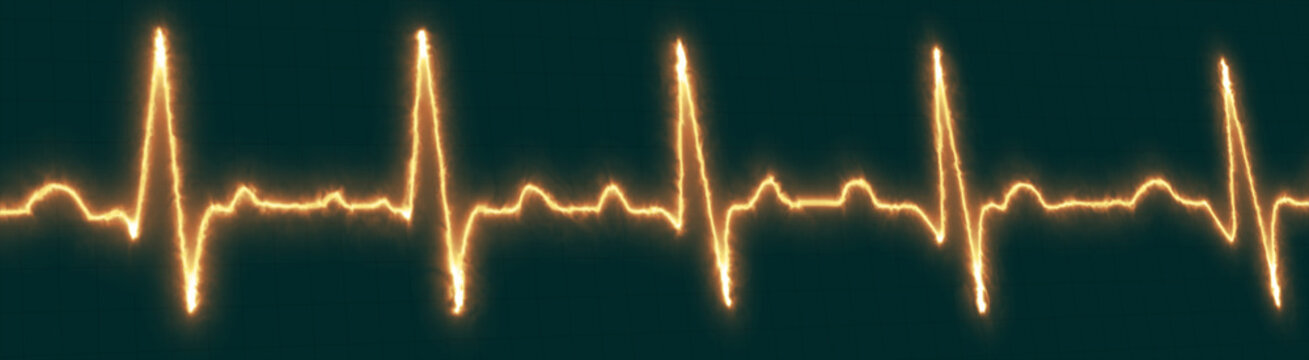 "Heartbeat Line" Images – Browse 625 Stock Photos, Vectors, and Video ...