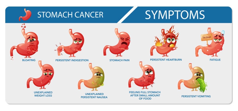 "Stomach Cancer" Images – Browse 2,825 Stock Photos, Vectors, and Video ...
