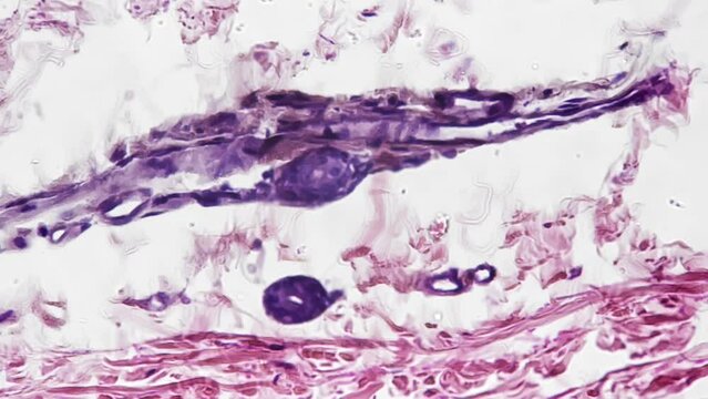 Simple Squamous Epithelium Slide 400x
