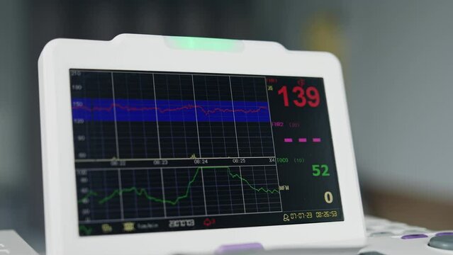 Tocodynamometer Bilder – Durchsuchen 810 Archivfotos, Vektorgrafiken ...