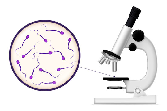 Spermogram bilder – Bläddra bland 306 stockfoton, vektorer och videor ...