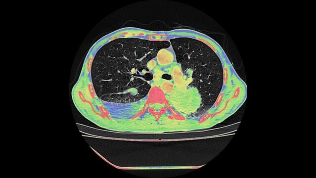 Nodul Images – Browse 1 Stock Photos, Vectors, and Video | Adobe Stock