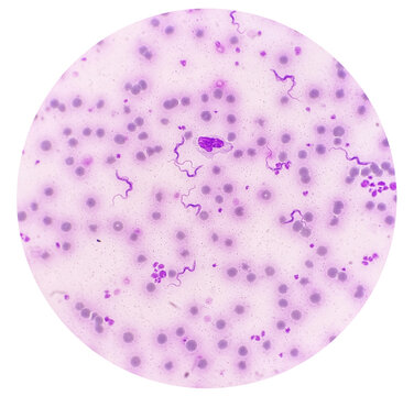 Trypanosoma Under Microscope Labeled