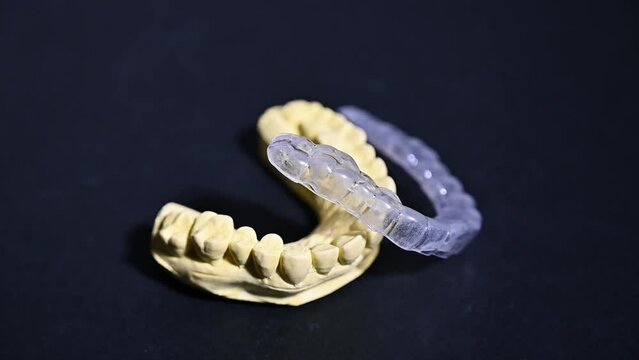 Invisalign Black Background Images – Browse 413 Stock Photos, Vectors ...