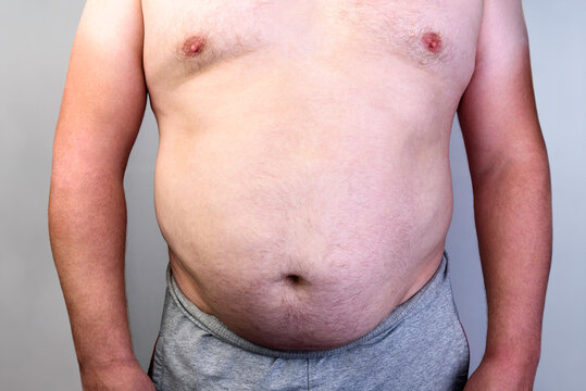 Viszeralfett Bilder – Durchsuchen 797 Archivfotos, Vektorgrafiken und ...