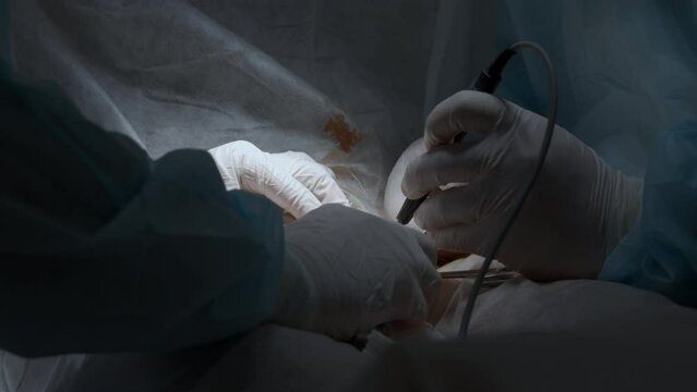 Cautery Imagens – Procure 1,750 fotos, vetores e vídeos | Adobe Stock