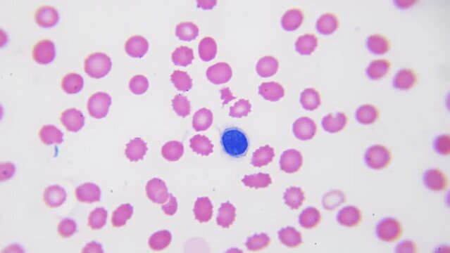 Neutrocytes Images – Browse 4,430 Stock Photos, Vectors, and Video ...