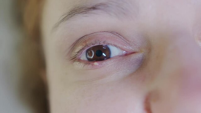 Blefarit bilder – Bläddra bland 1,184 stockfoton, vektorer och videor ...