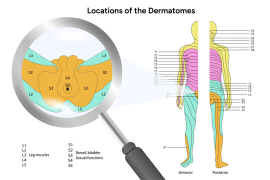 รูปภาพDermatome – เลือกดูภาพถ่ายสต็อก เวกเตอร์ และวิดีโอ157 | Adobe Stock
