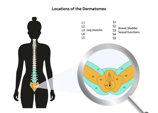Dermatome Images – Browse 142 Stock Photos, Vectors, and Video | Adobe ...