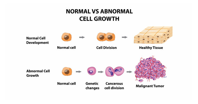 Abnormal Cell Templates – Free Editable Designs | PikWizard