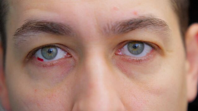 รูปภาพCorneas – เลือกดูภาพถ่ายสต็อก เวกเตอร์ และวิดีโอ38,407 | Adobe Stock
