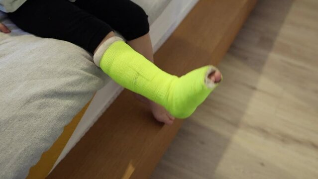 "Leg Cast" Images – Browse 293 Stock Photos, Vectors, and Video | Adobe ...