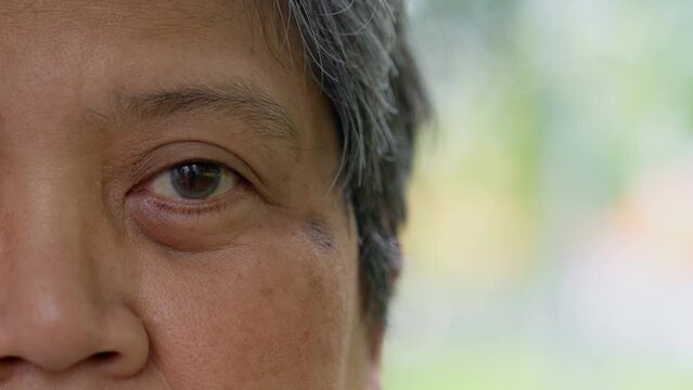 Phacoemulsification Images – Browse 510 Stock Photos, Vectors, and Video | Adobe Stock