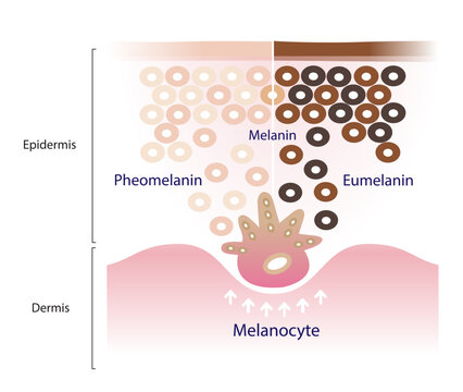 รูปภาพMelanocyte – เลือกดูภาพถ่ายสต็อก เวกเตอร์ และวิดีโอ6,185 | Adobe ...