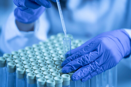 "Water Testing" Images – Browse 1,410 Stock Photos, Vectors, and Video ...