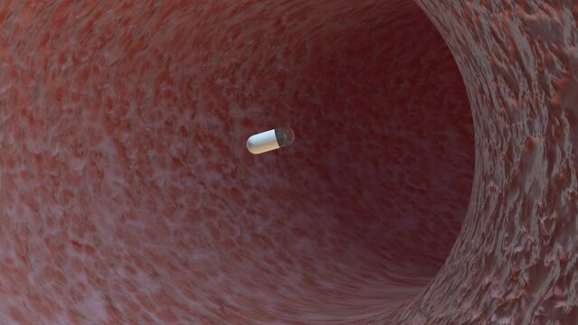 "Capsule Endoscopy"-Bilder: Stock-Fotos & -Videos. | Adobe Stock