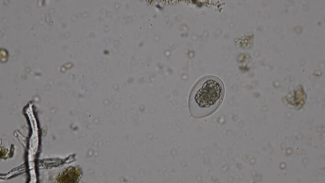 "Trichuris Trichiura" Images – Browse 1,544 Stock Photos, Vectors, and ...