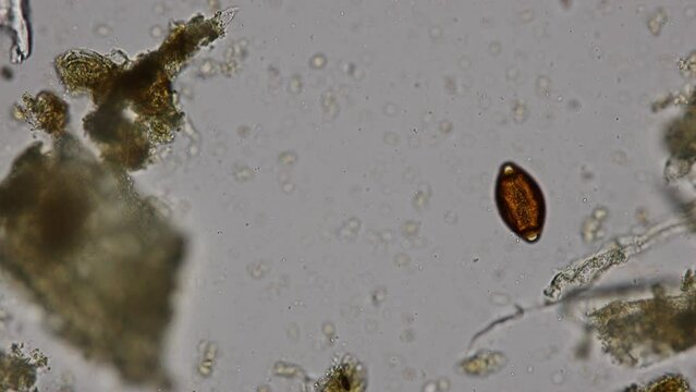 "Trichuris Trichiura" Images – Browse 1,290 Stock Photos, Vectors, and ...