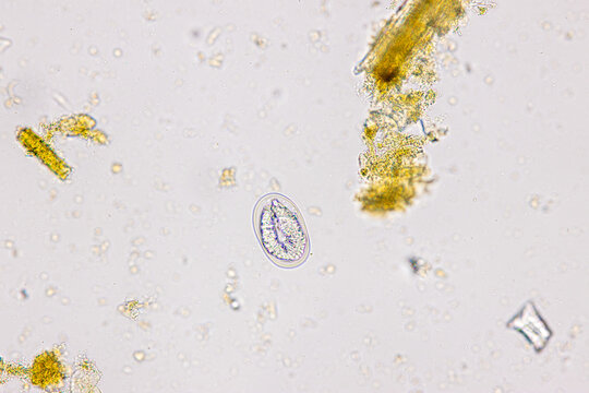 "Enterobius Vermicularis" Images – Browse 2,341 Stock Photos, Vectors ...