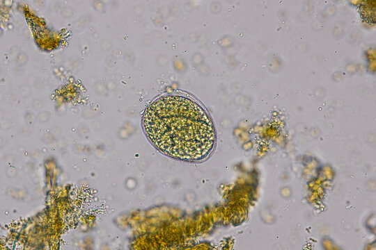 "Enterobius Vermicularis" Images – Browse 2,341 Stock Photos, Vectors ...