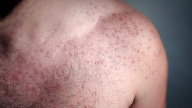 Unhygienic Bilder – Durchsuchen 82,853 Archivfotos, Vektorgrafiken und ...