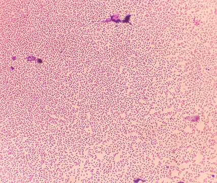 "Typhoid Fever" Images – Browse 2,581 Stock Photos, Vectors, and Video ...