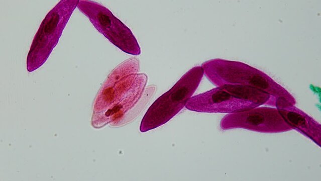 Paramecium Caudatum 400x Microscope Image From