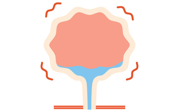 Imágenes de Poliuria: descubre bancos de fotos, ilustraciones, vectores ...