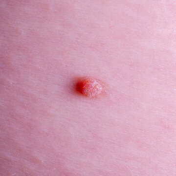 Basaliom-Bilder: Stock-Fotos & -Videos. | Adobe Stock