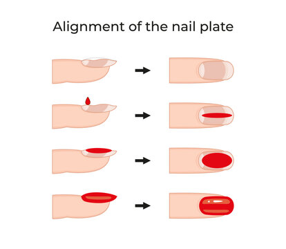 "Nail Plate" Images – Browse 2,356 Stock Photos, Vectors, and Video ...