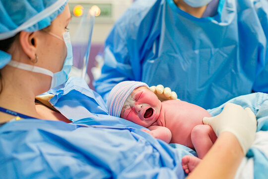 "Baby Delivery" Images – Browse 396 Stock Photos, Vectors, and Video ...