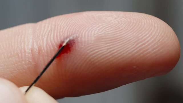 "Prick - Images et vidéos libres de droits | Adobe Stock