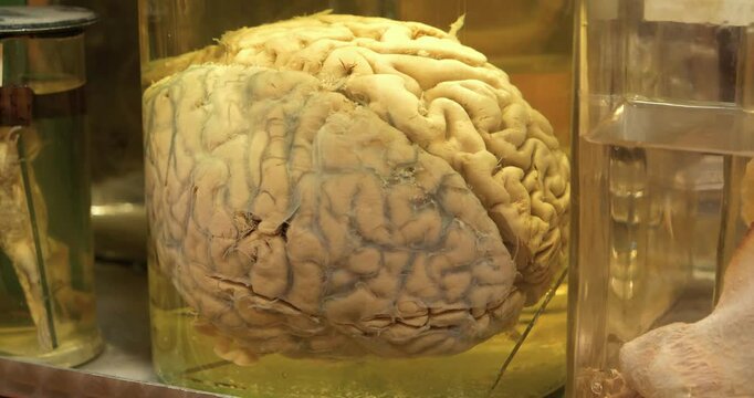 Real Brain Images – Browse 7,807 Stock Photos, Vectors, and Video ...