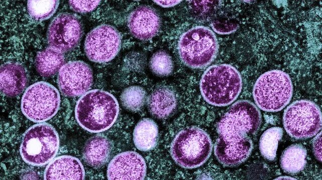 รูปภาพPoxvirus – เลือกดูภาพถ่ายสต็อก เวกเตอร์ และวิดีโอ4,967 | Adobe Stock