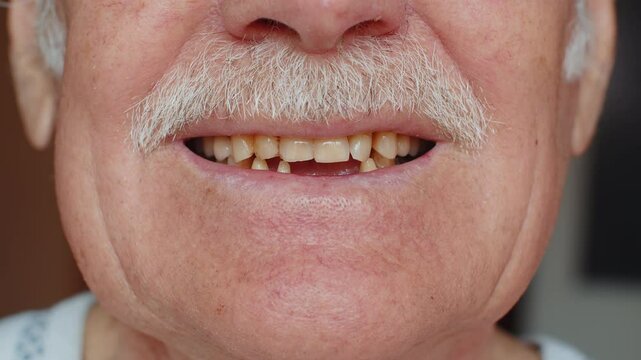 Toothless Man Images – Browse 1,618 Stock Photos, Vectors, and Video ...