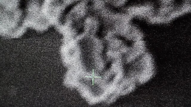 Scanning Electron Microscope Images – Browse 4,886 Stock Photos ...