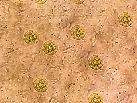 Entamoeba Histolytica Under Microscope