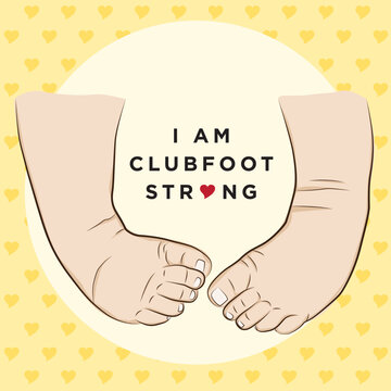 Clubfoot Images – Browse 1,777 Stock Photos, Vectors, and Video | Adobe ...