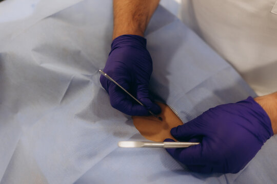 "Arterial Bleeding" Images – Browse 245,120 Stock Photos, Vectors, and ...