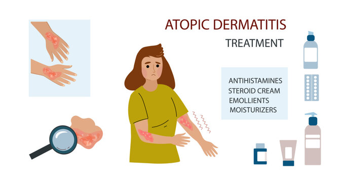 รูปภาพNeurodermatitis – เลือกดูภาพถ่ายสต็อก เวกเตอร์ และวิดีโอ686 ...