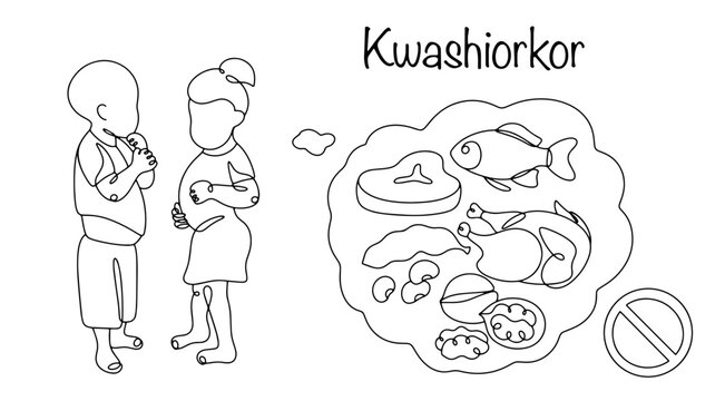 Kwashiorkor-Bilder: Stock-Fotos & -Videos. | Adobe Stock