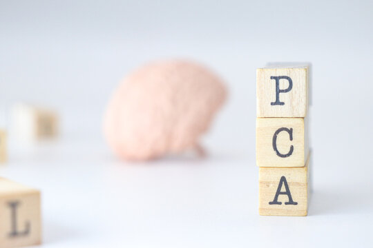 รูปภาพPca – เลือกดูภาพถ่ายสต็อก เวกเตอร์ และวิดีโอ714 | Adobe Stock